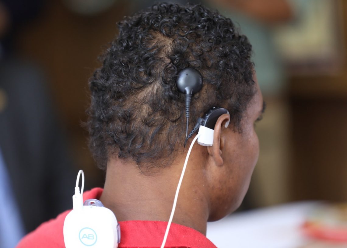 Walter Mejía, de 33 años, recupera audición con implante coclear ...